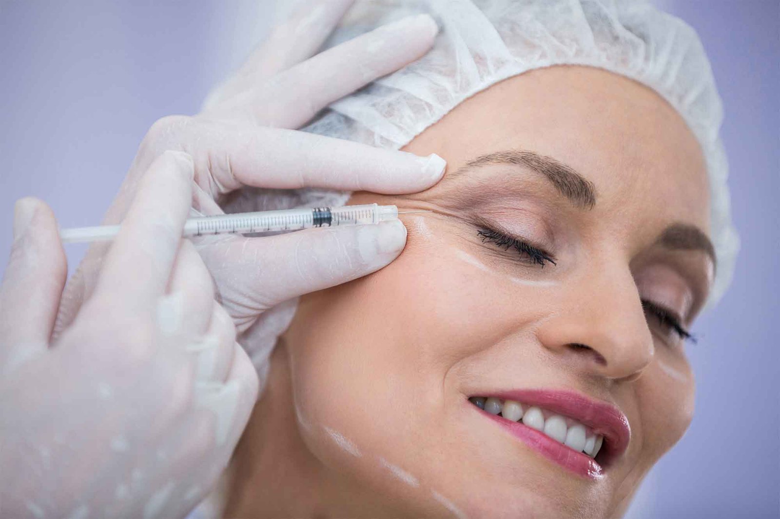 Botox – Advanced GloSkin